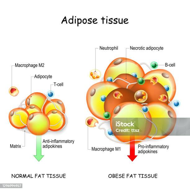 Adipocytes Obesity And Inflammation Stock Illustration - Download Image ... Adipocytes Obesity And Inflammation Stock Illustration - Download Image ...