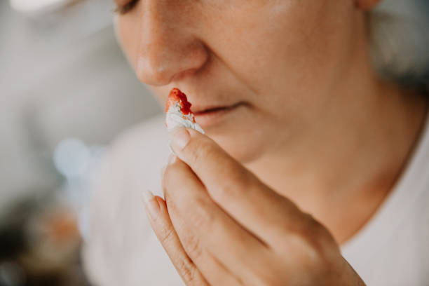 Nosebleed Pictures | Download Free Images on Unsplash