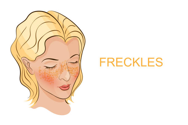 Young Woman With Freckles Illustrations Royalty Free Vector Graphics
