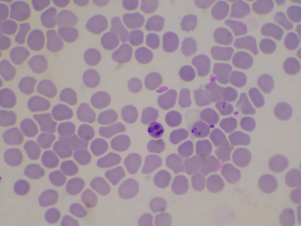 Free picture: plasmodium vivax, ring, erythrocyte, parasite