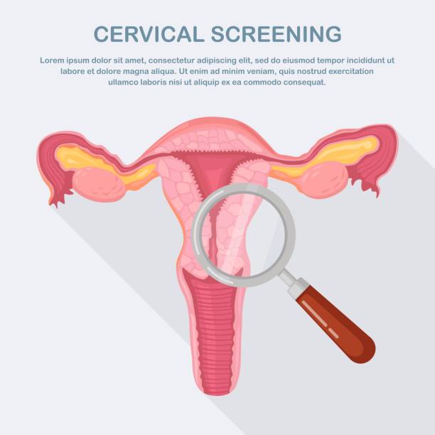 1200 Cervical Cancer Screening Illustrations Stock Illustrations