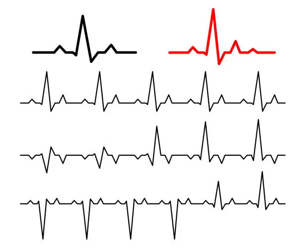 Free normal ecg graph Illustrations & Vectors | Templates, Icons & More ... Free normal ecg graph Illustrations & Vectors | Templates, Icons & More ...