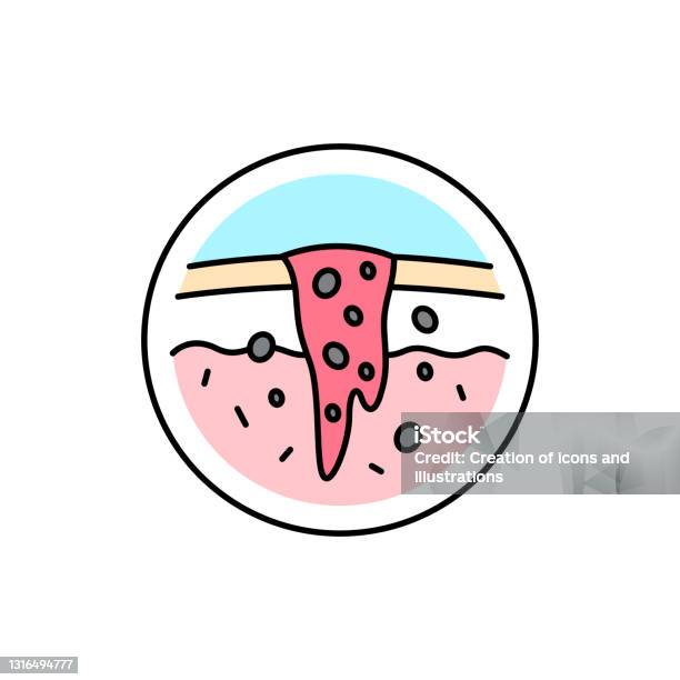 Nodular Color Line Icon Dermatology Disease Isolated Vector Element