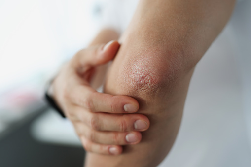 Autoimmune Pictures Download Free Images On Unsplash