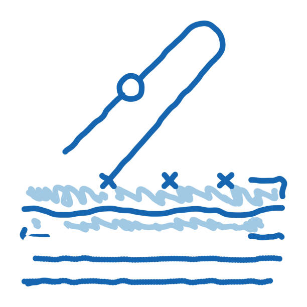 140+ Surgical Incision Stock Illustrations, Royalty-Free Vector ... 140+ Surgical Incision Stock Illustrations, Royalty-Free Vector ...