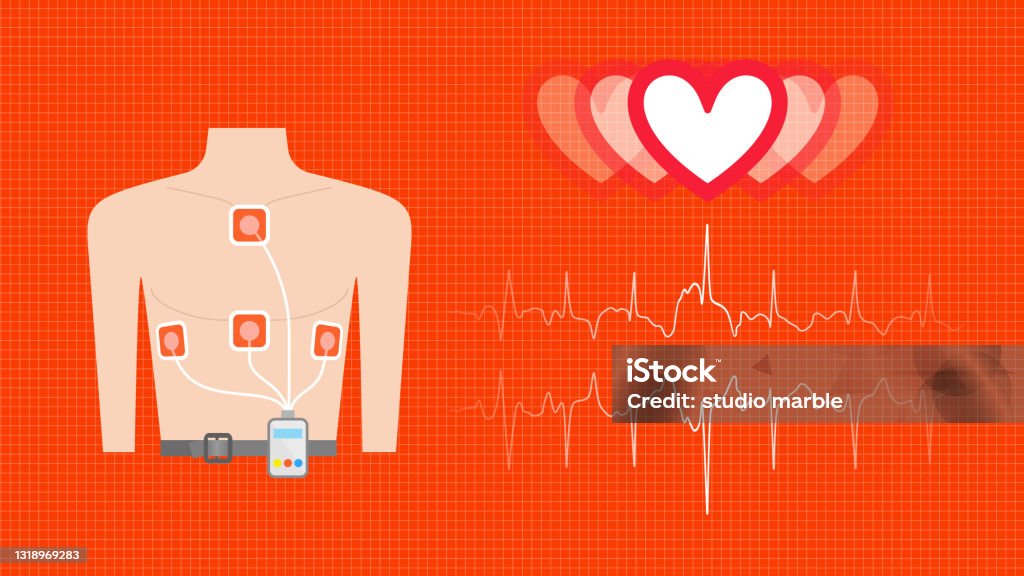 Man Wearing An Electrocardiograph And An Electrocardiogram Stock
