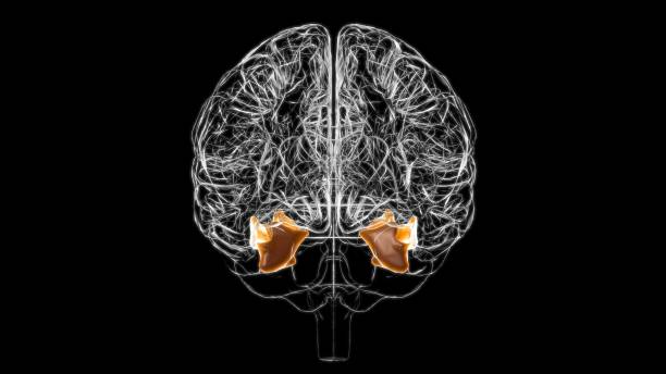 Occipitotemporal Gyrus