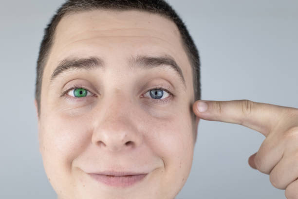 850 Fotos Bilder Und Lizenzfreie Bilder Zu Zwei Augenfarben Istock