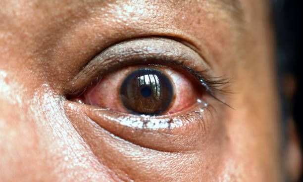 Red Eye Pictures | Download Free Images on Unsplash
