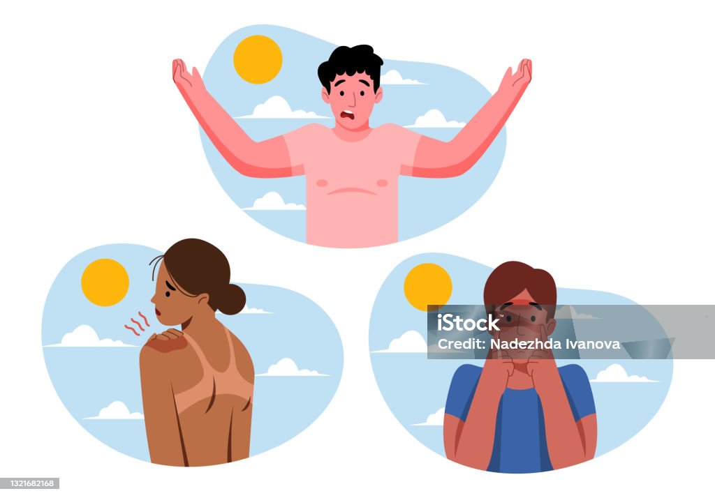 Group Of Different People With A Sunburn Vector Illustration Stock
