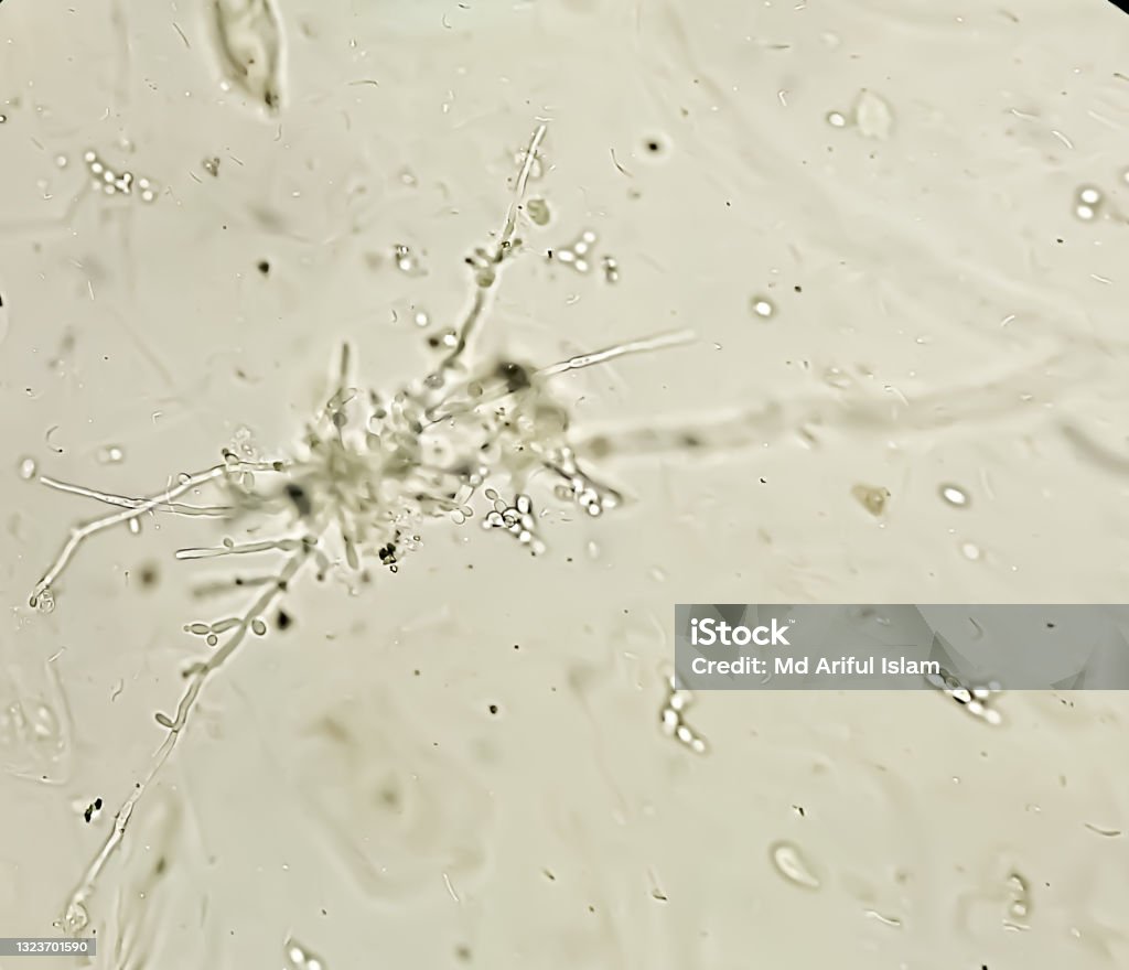 Infeksi Jamur Pemula Ragi Dan Pseudohyphae Dari Candida Albicans Jamur
