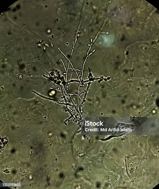 Infeksi Jamur Pemula Ragi Dan Pseudohyphae Dari Candida Albicans Jamur