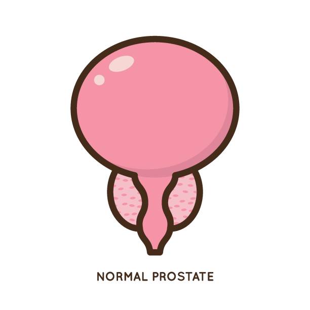 150 Prostate Hypertrophy Illustrations Royalty Free Vector Graphics And Clip Art Istock