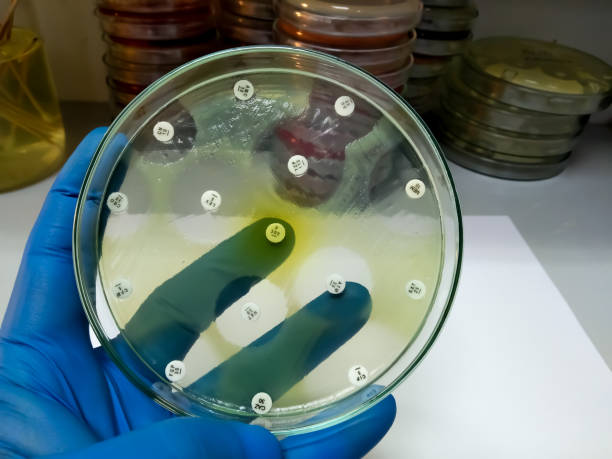 Free picture: yersinia pestis, bacteria, grown, petri, dish, blood agar