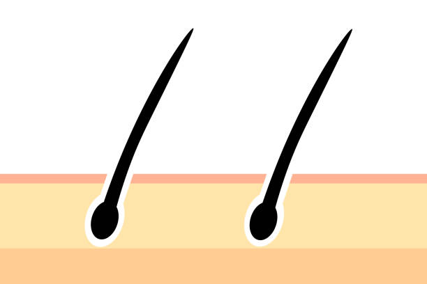 1 600 Human Hair Follicle Stock Illustrations Royalty Free Vector