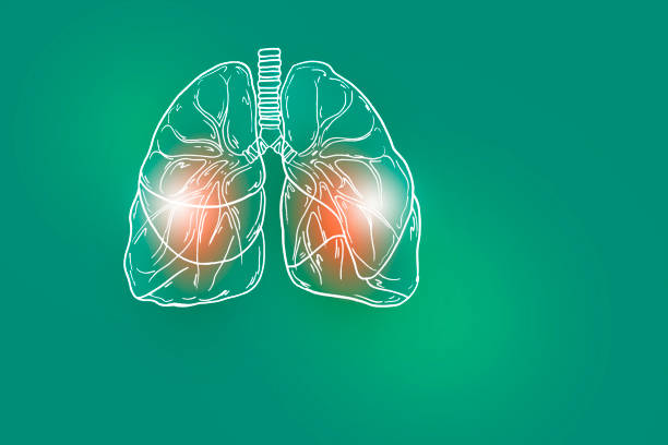 80 Cystic Fibrosis Lungs Stock Illustrations Royalty Free Vector