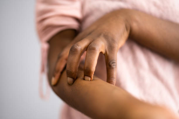 Skin Condition Pictures | Download Free Images on Unsplash