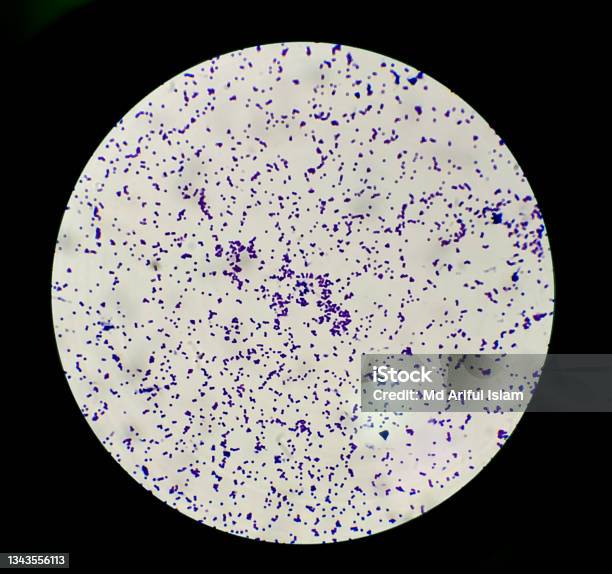 Colonies Gram Stain Under 100x Light Microscope Show Gram Positive ... Colonies Gram Stain Under 100x Light Microscope Show Gram Positive ...