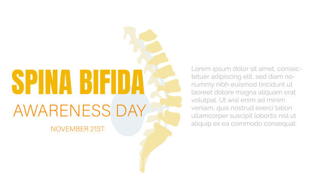 20 Spinal Bifida Stock Illustrations Royalty Free Vector Graphics