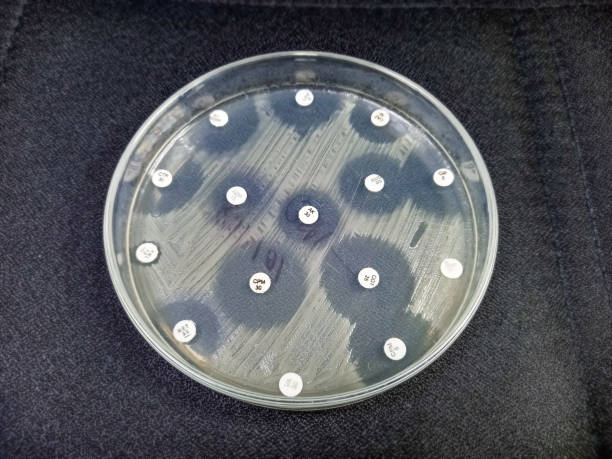 410+ Antimicrobial Susceptibility Testing Stock Photos, Pictures ... 410+ Antimicrobial Susceptibility Testing Stock Photos, Pictures ...