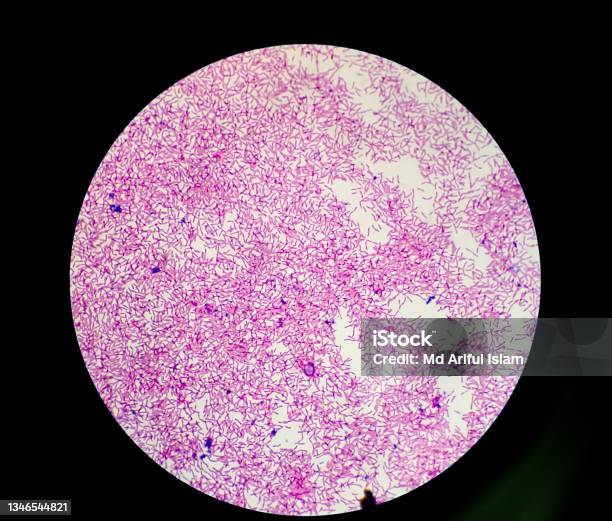 Escherichia Coli Also Known As E Coli Is A Gramnegative Facultative Anaerobic Rodshaped