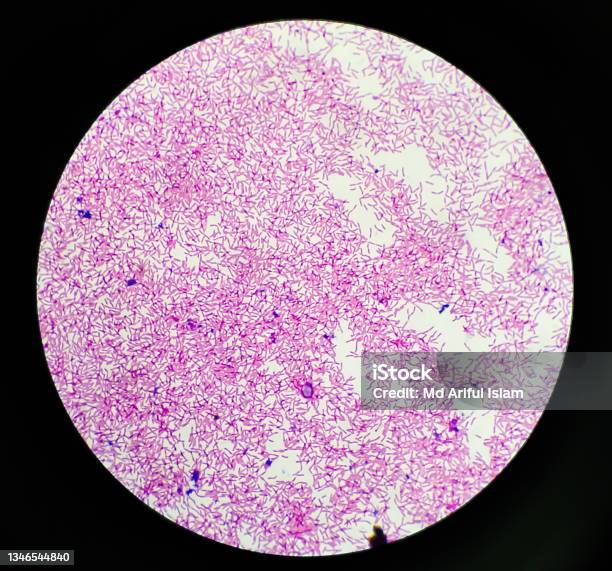 Escherichia Coli Also Known As E Coli Is A Gramnegative Facultative Anaerobic Rodshaped