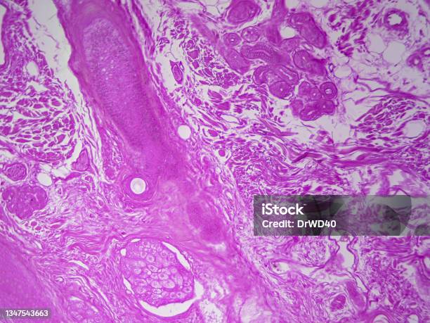 Folículo Piloso Que Muestra Glándulas Sudoríparas Sebáceas Y Ecrinas Foto De Stock Y Más Banco