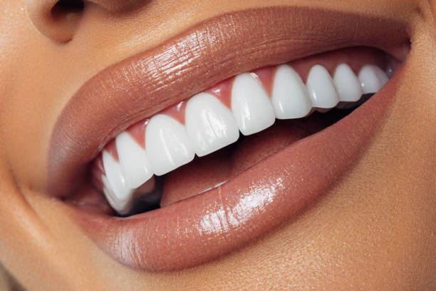 Free white teeth stock photos. Download the best free white teeth ...