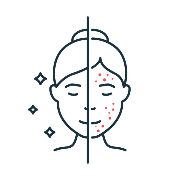 5 200 Acne Icon Stock Illustrations Royalty Free Vector Graphics