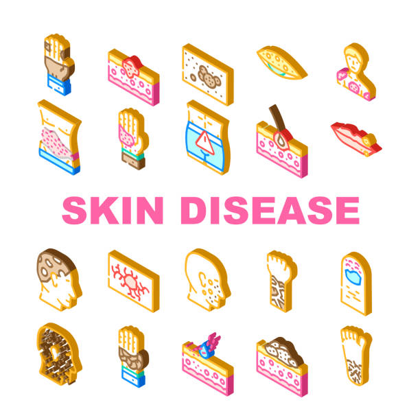 110 Ichthyosis Skin Stock Illustrations Royalty Free Vector Graphics