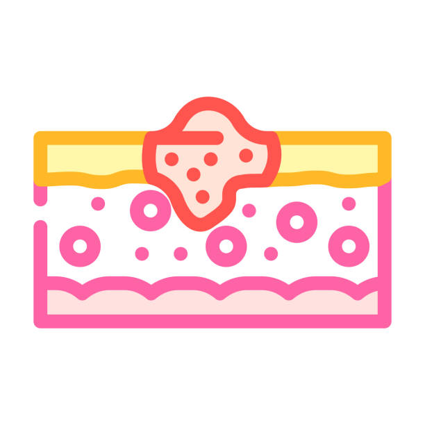 70 Ichthyosis Skin Stock Illustrations Royalty Free Vector Graphics