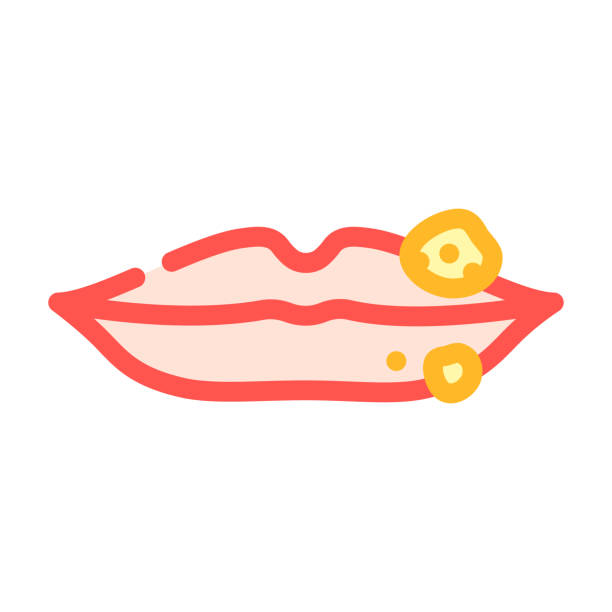 70 Ichthyosis Skin Stock Illustrations Royalty Free Vector Graphics