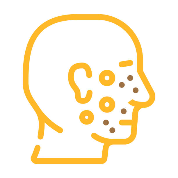 70 Ichthyosis Skin Stock Illustrations Royalty Free Vector Graphics