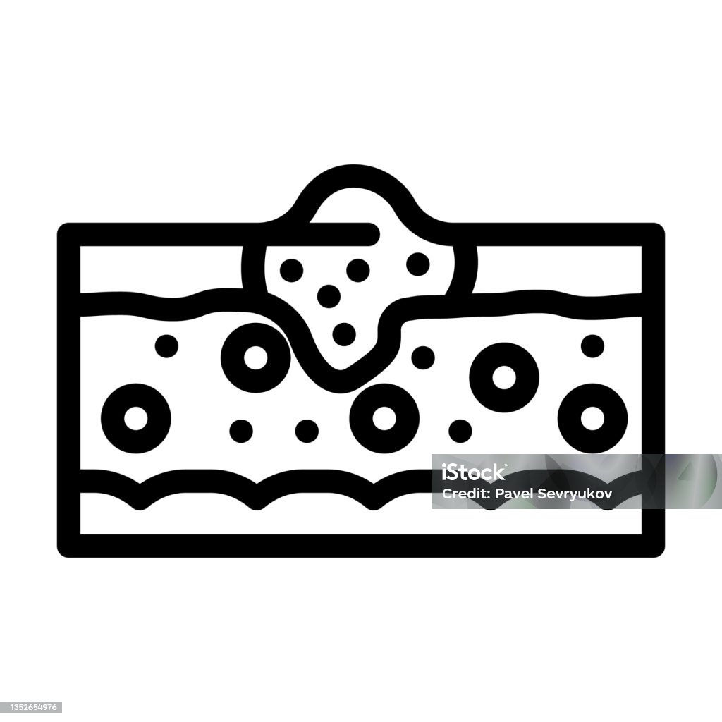 Abstract Problem Skin Disease Line Icon Vector Illustration Stock