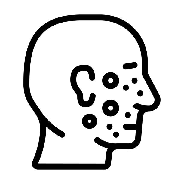 110 Ichthyosis Skin Stock Illustrations Royalty Free Vector Graphics