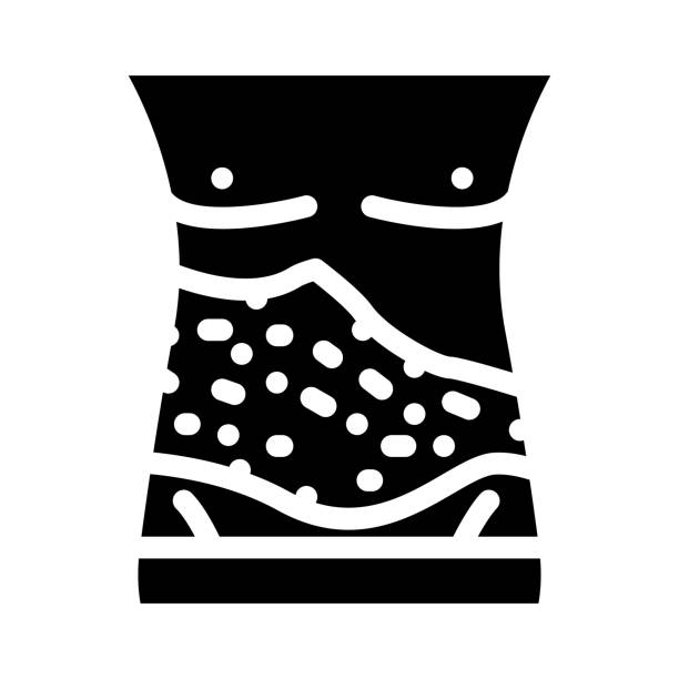 70 Ichthyosis Skin Stock Illustrations Royalty Free Vector Graphics