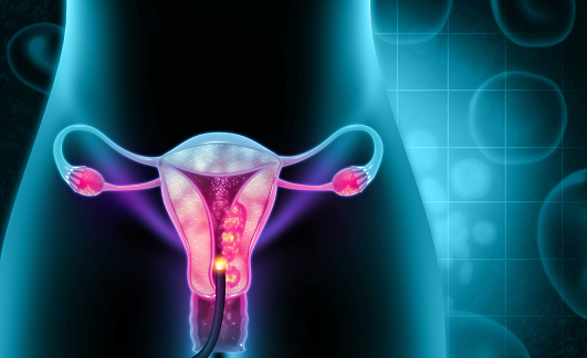 Foto De Dilatação E Curetagem D E Cendometrial Biópsiacâncer Cervical3d Ilustração E Mais Fotos