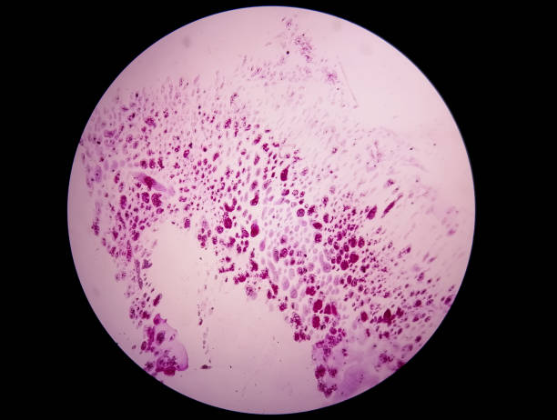 Free picture: gram, positive, bacteria, tuberculosis, bacteria