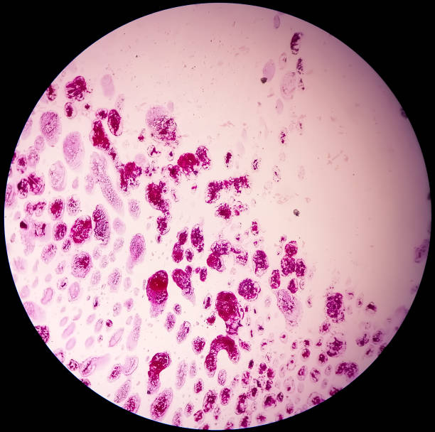 Free picture: gram, positive, bacteria, tuberculosis, bacteria