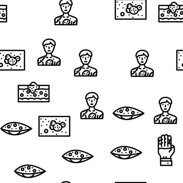 110 Ichthyosis Skin Stock Illustrations Royalty Free Vector Graphics