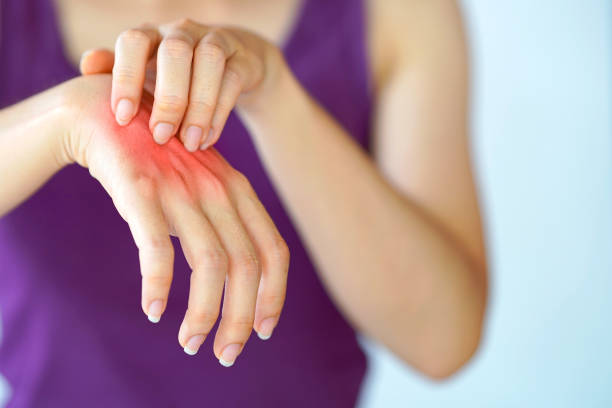 50+ Infected Forearm From Mosquito Bite Stock Photos, Pictures ... 50+ Infected Forearm From Mosquito Bite Stock Photos, Pictures ...