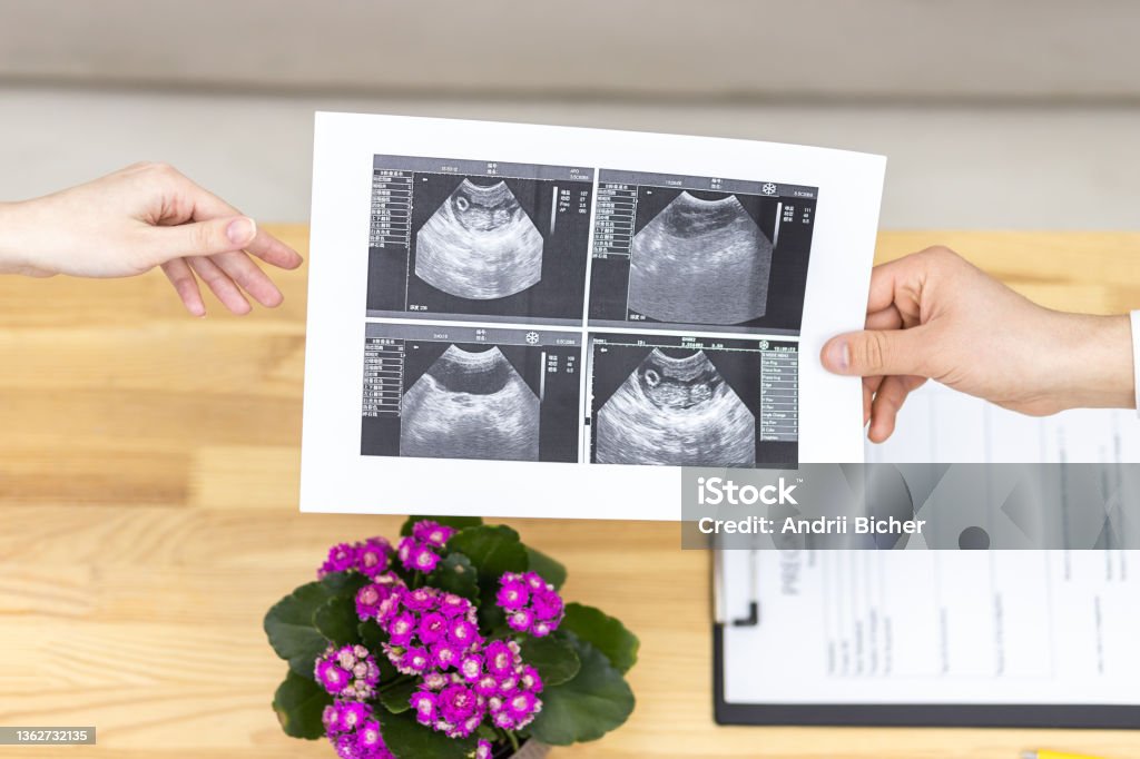Foto Foto Usg Di Atas Meja Dan Dua Tangan Foto Stok - Unduh Gambar ... Foto Foto Usg Di Atas Meja Dan Dua Tangan Foto Stok - Unduh Gambar ...