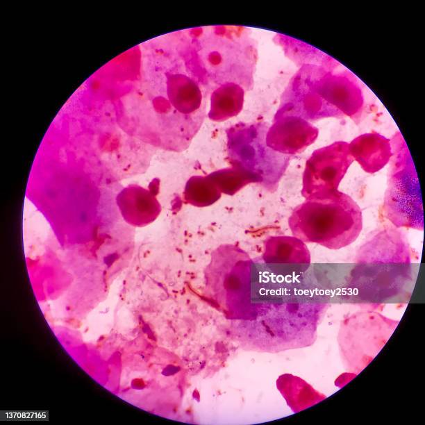 Sel Bakteri Gram Neagative Bacilli Dengan Kapsul Contoh Dahak Dalam