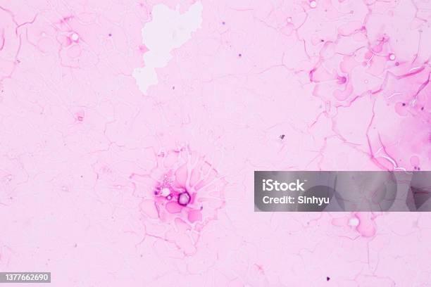 Anatomi Dan Ovarium Histologis Testis Dan Sperma Sel Manusia Di Bawah