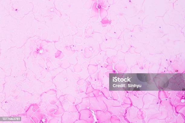 Anatomi Dan Ovarium Histologis Testis Dan Sperma Sel Manusia Di Bawah