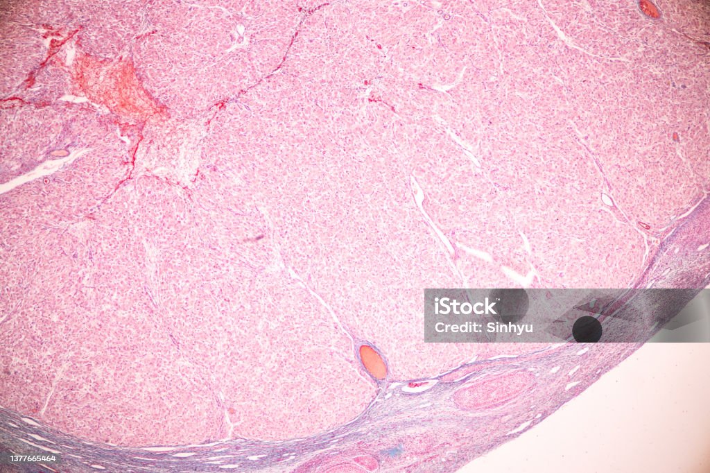 Anatomi Dan Ovarium Histologis Testis Dan Sperma Sel Manusia Di Bawah