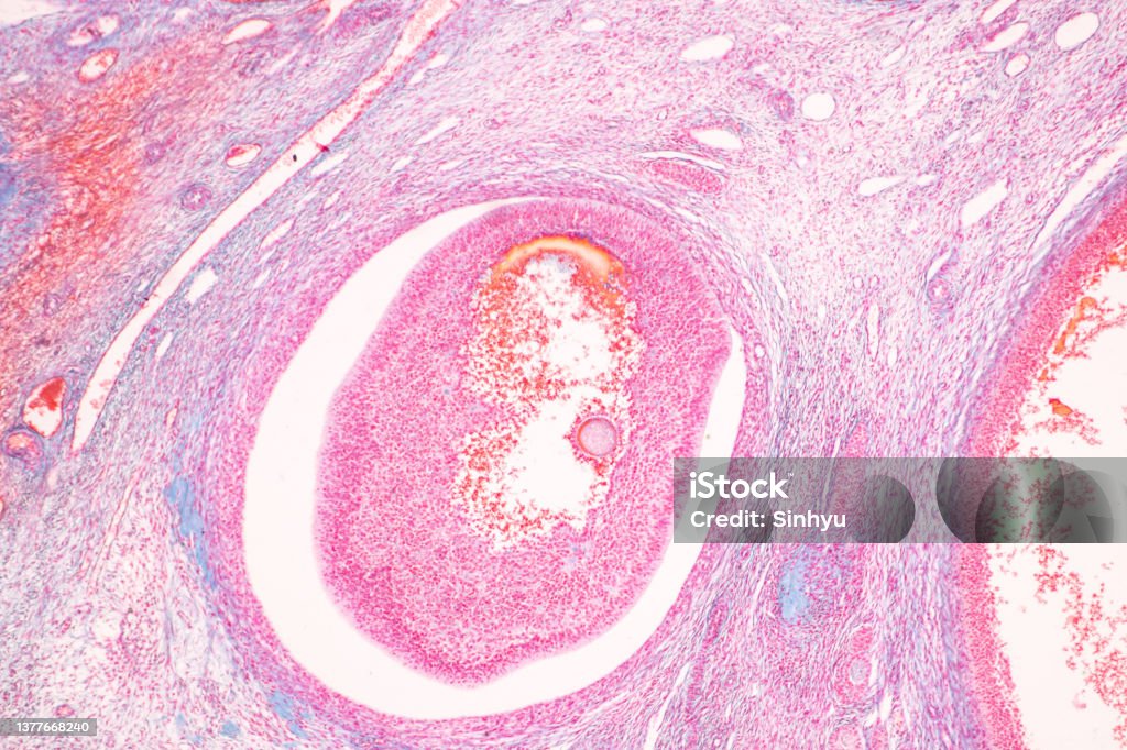 Anatomi Dan Histologis Ovarium Testis Dan Sperma Sel Manusia Di Bawah