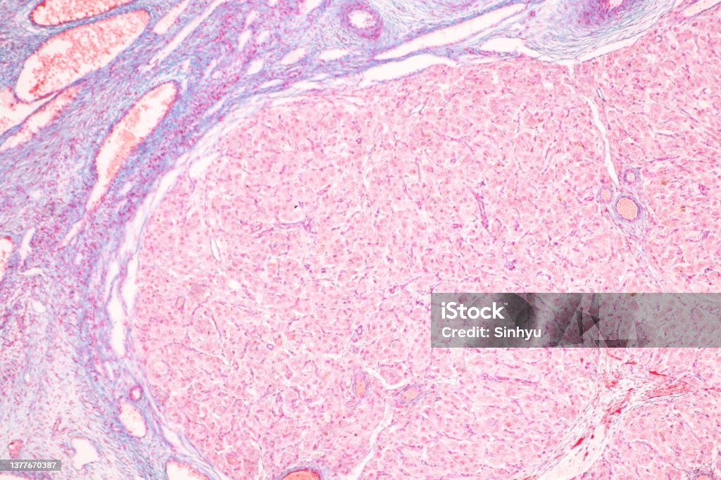 Anatomi Dan Ovarium Histologis Testis Dan Sperma Sel Manusia Di Bawah
