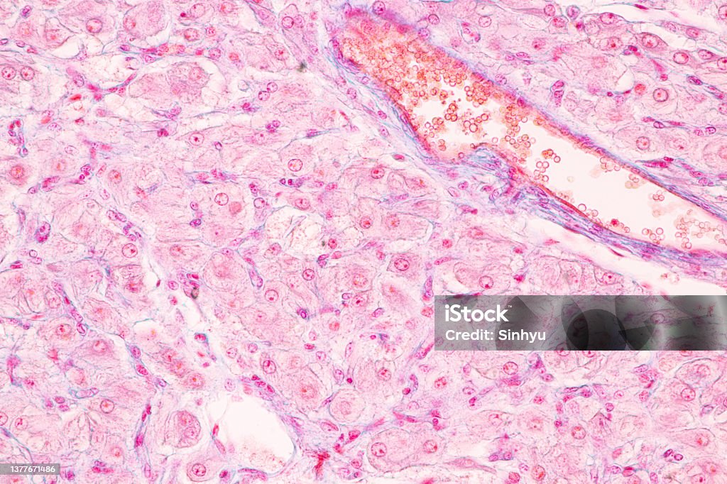 Anatomi Dan Histologis Ovarium Testis Dan Sperma Sel Manusia Di Bawah