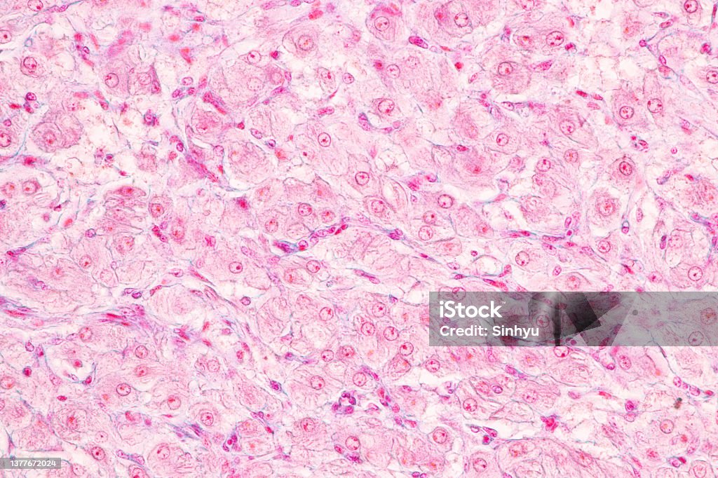 Anatomi Dan Ovarium Histologis Testis Dan Sperma Sel Manusia Di Bawah